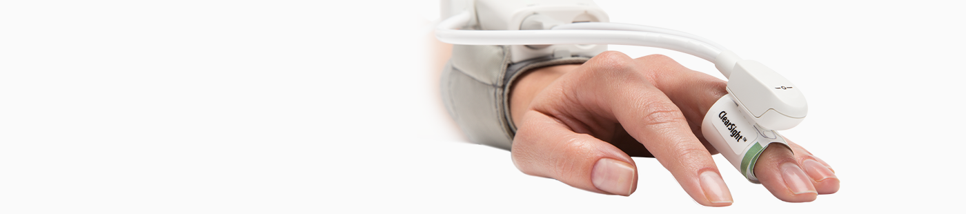 Sistema ClearSight | Edwards Lifesciences